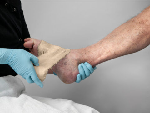 Ichthopaste Application Guide - Gaia Medical