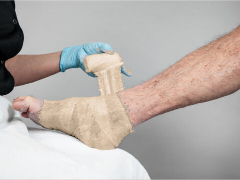 Ichthopaste Application Guide - Gaia Medical