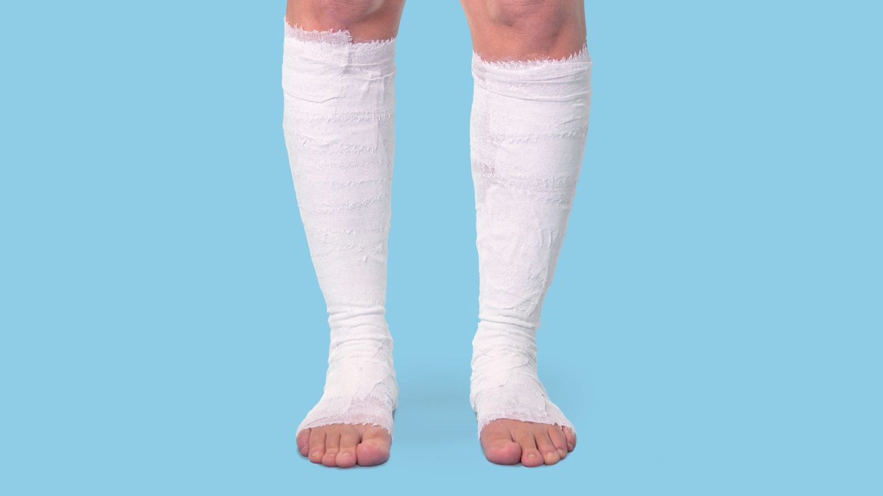 Supporting Surrounding Skin with Soothing Zinc Paste Bandages
